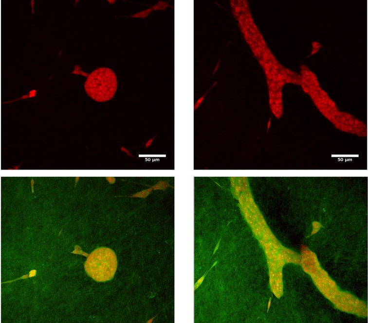 Theoretical approach of ductal morphogenesis - Maël Montévil